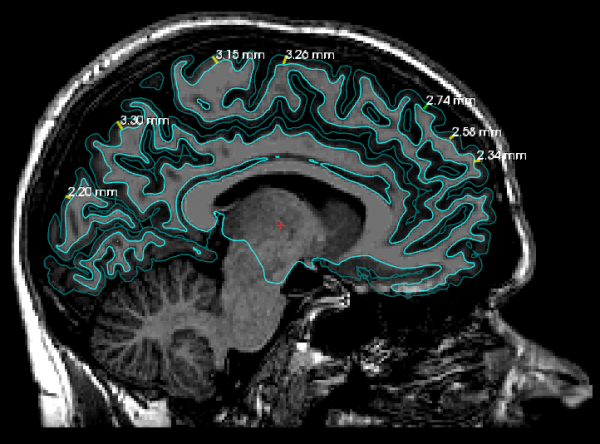 Health surveillance of the brain and psychological state program with ...
